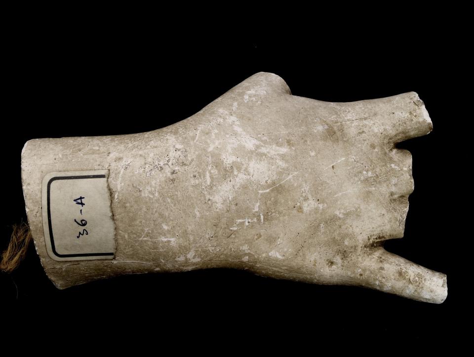 Cast of an Unidentified Right Hand, Shown Open (all fingers missing ...