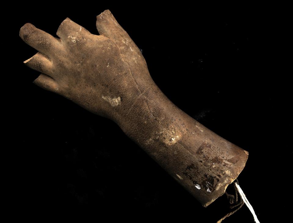 Cast of an Unidentified Child's Left Hand and Forearm (all fingers ...